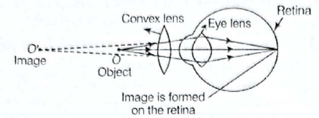Solutions-NCERT-Class-10-Science-Chapter-10-Human Eye and Colourful ...